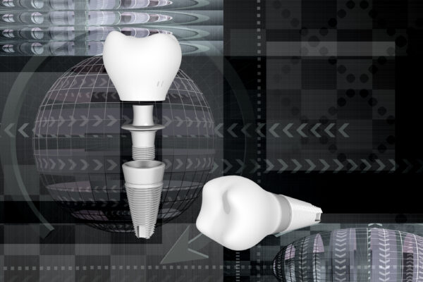 Services | Ann Arbor's Dentist