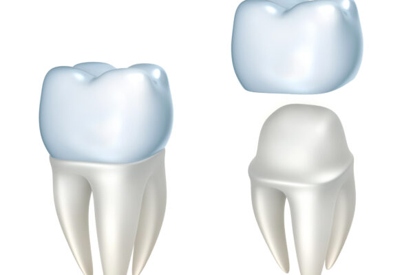 Services | Ann Arbor's Dentist